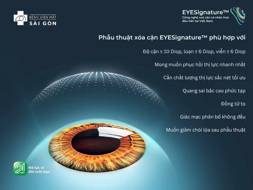 Phẫu thuật EYESignature™ - Công Nghệ Xóa Cận Cá Nhân Hóa Tiên Tiến