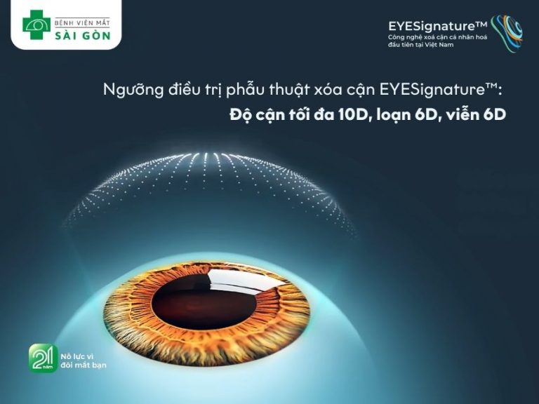 Phẫu thuật EYESignature™ - Công Nghệ Xóa Cận Cá Nhân Hóa Tiên Tiến