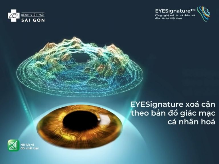 Phẫu thuật EYESignature™ - Công Nghệ Xóa Cận Cá Nhân Hóa Tiên Tiến